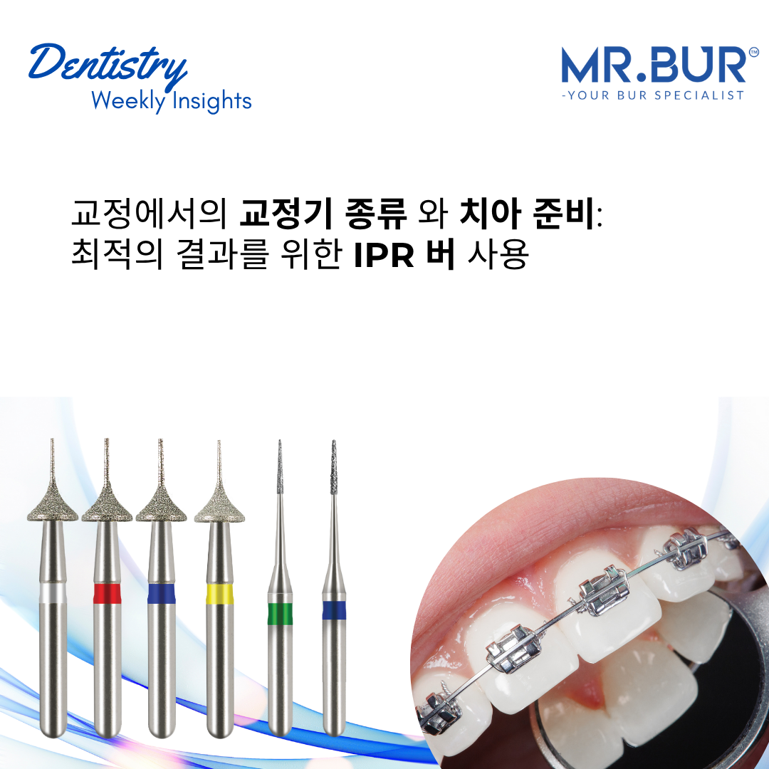 교정 및 치아 준비에서 교정기의 종류: 최적의 결과를 위해 IPR 버 사용하기 – Mr Bur Korea